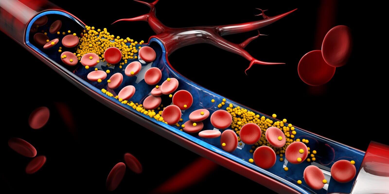 What Tests Are Done During A Cholesterol Screening Imperial Center Family Medicine