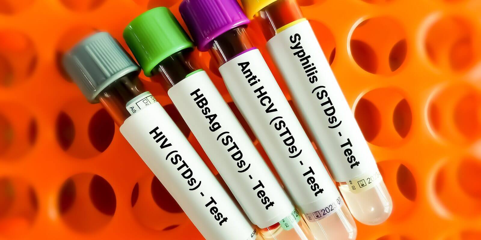 6 Signs You May Have A Sexually Transmitted Disease (STD) - Imperial ...