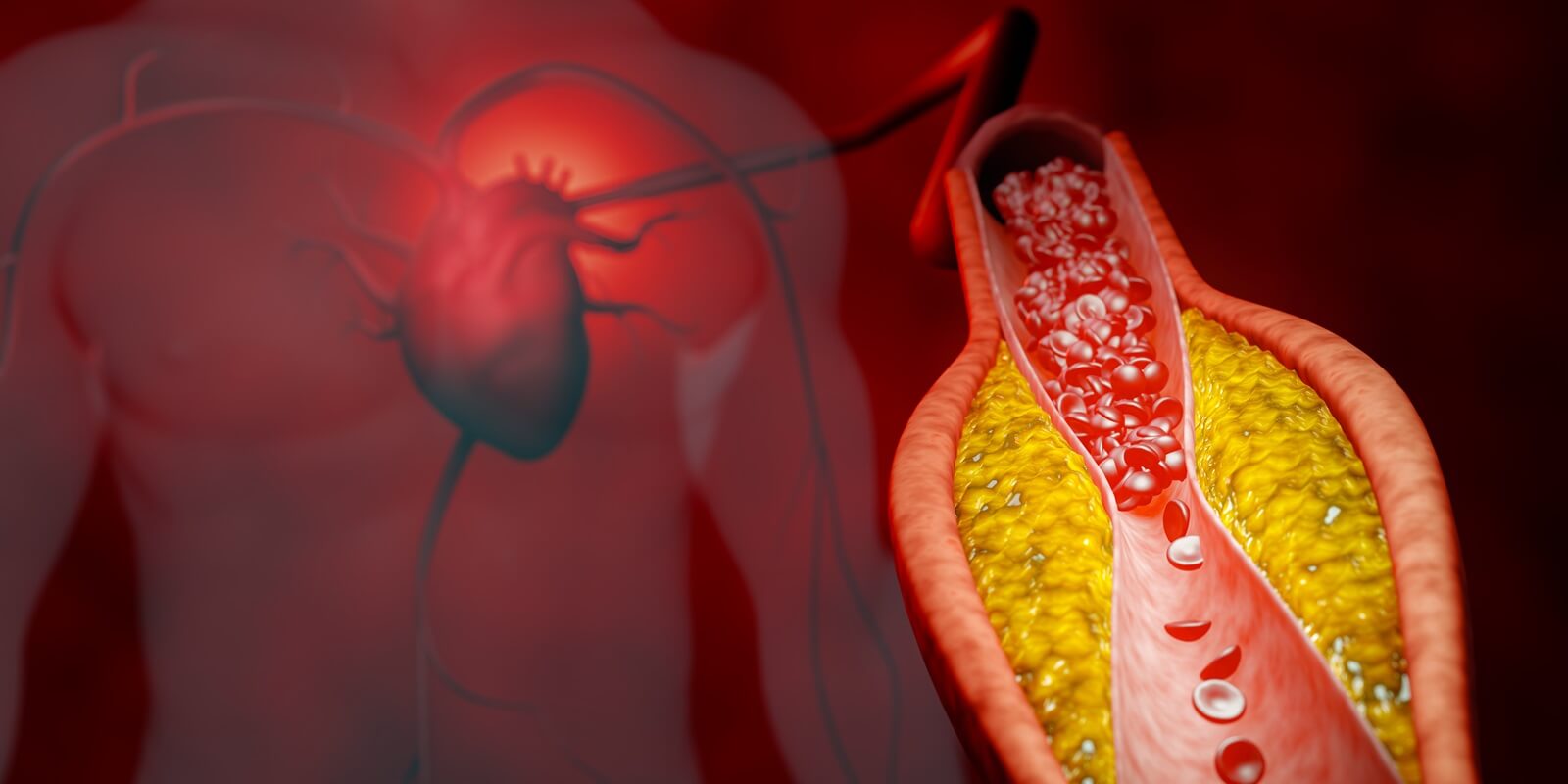 6 Therapy Treatments for High LDL Cholesterol - Imperial Center Family Medicine