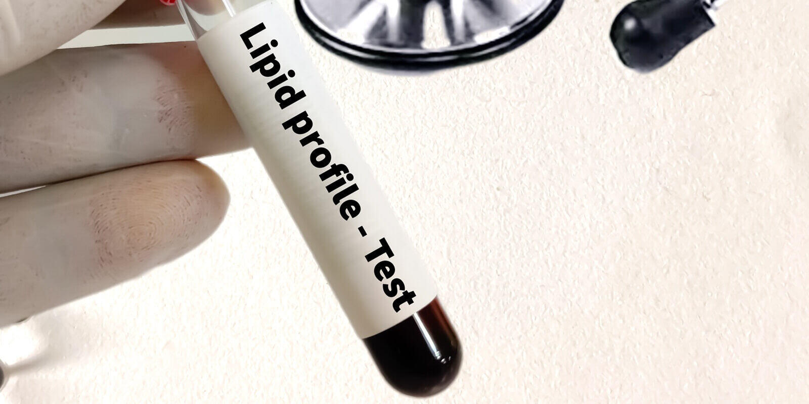 What’s the Difference Between Lipid Panels and Cholesterol Screenings ...